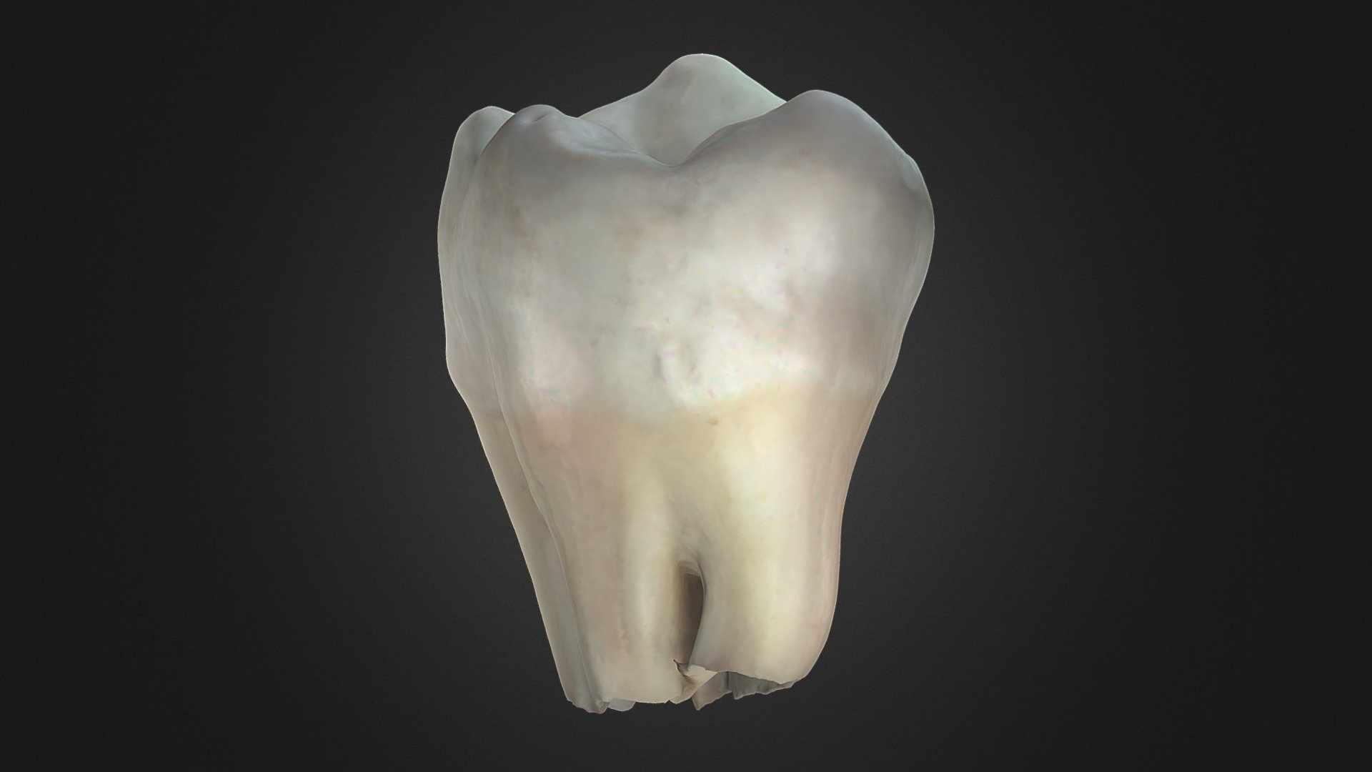 Dente 28 - Upper Left Third Molar (ID 28e) - Download Free 3D model by ...