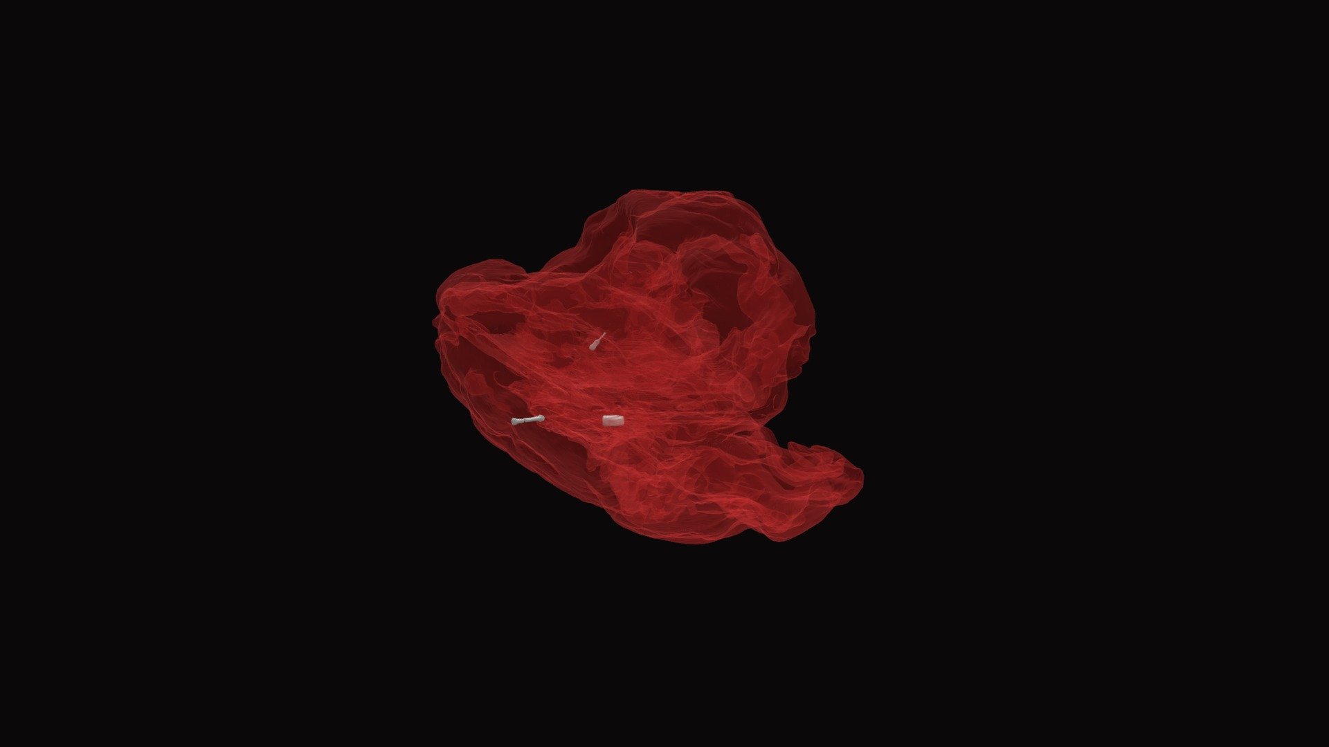 Heart0032, Elderly Female Heart, Pacemaker Leads - Download Free 3D ...