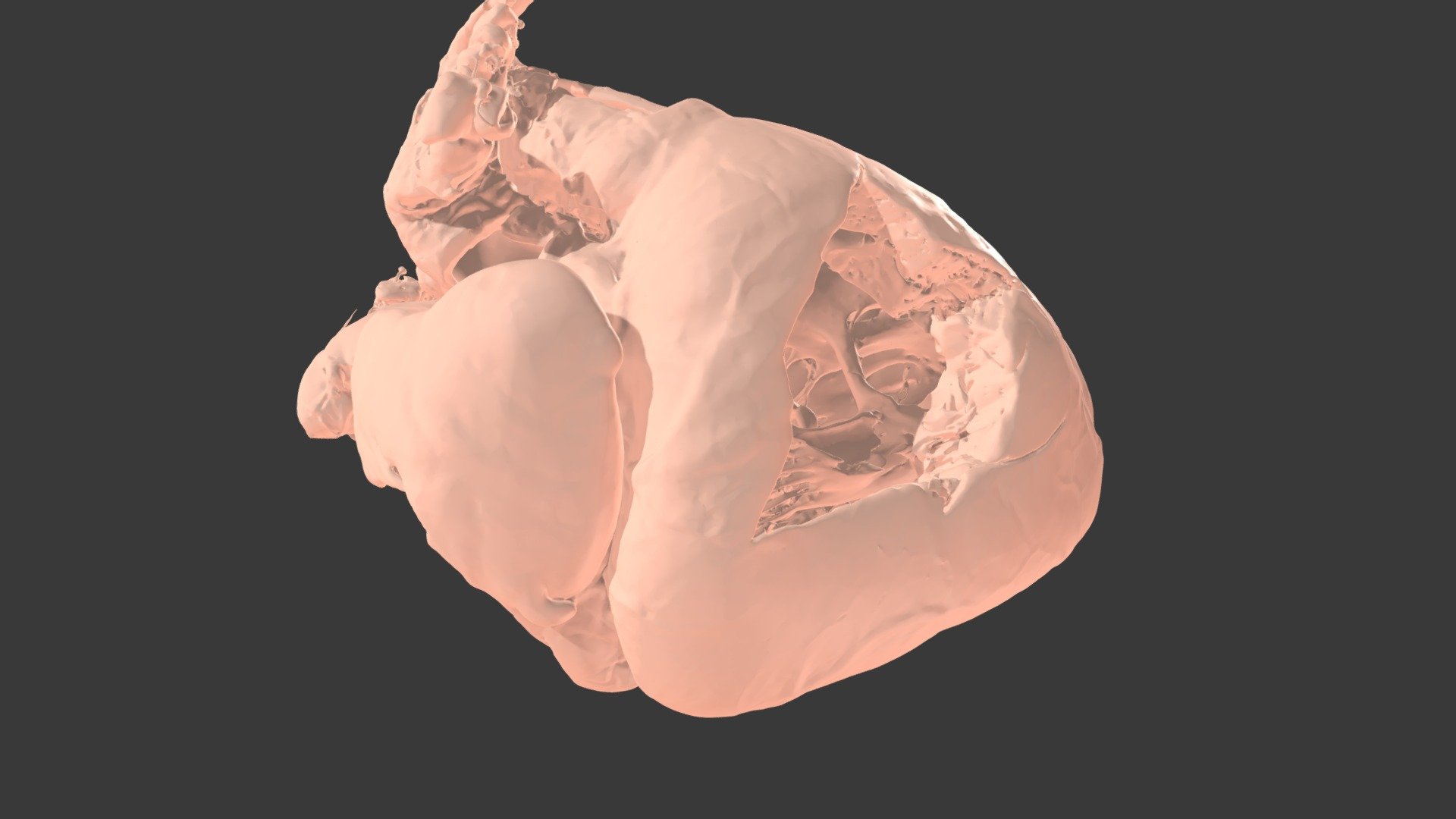 DORV #4 - DORV {S,D,D} with Subpulmonary VSD - 3D model by heartmodels ...