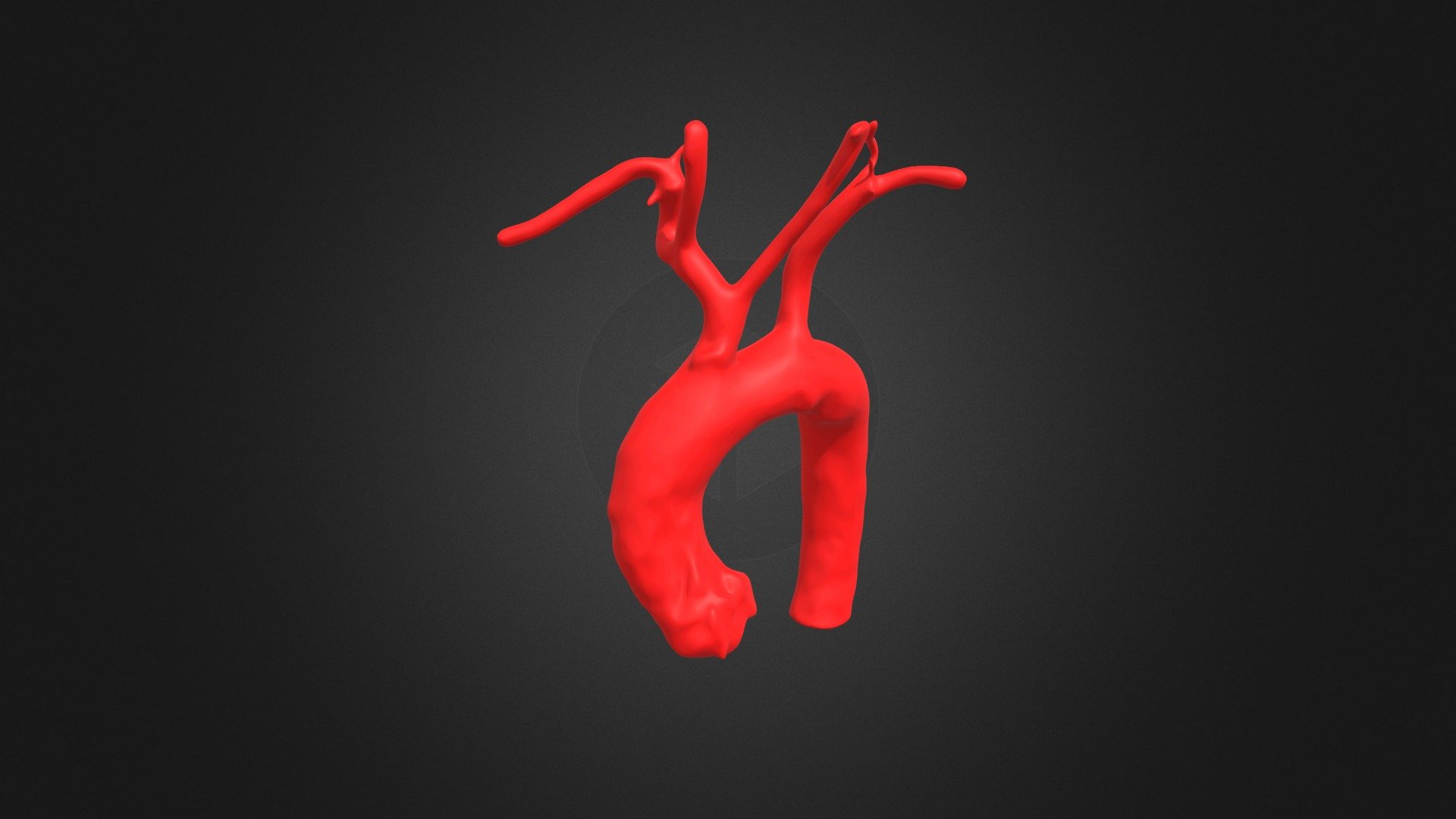 Long Common Trunk Aortic Variant - 3D model by phdang [b61cff7] - Sketchfab