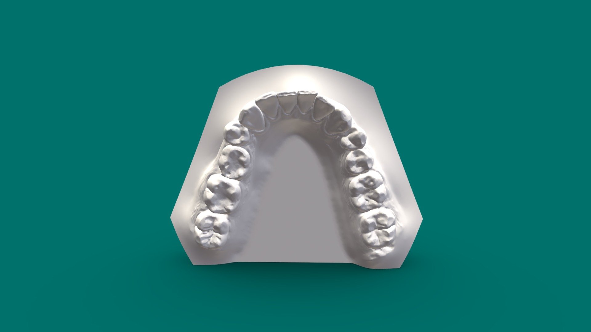 Maxillary Dental Model - 3D model by FunctionalResearch_3D ...