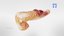 Chronic Pancreatitis - Download Free 3D model by Liz Paton ...
