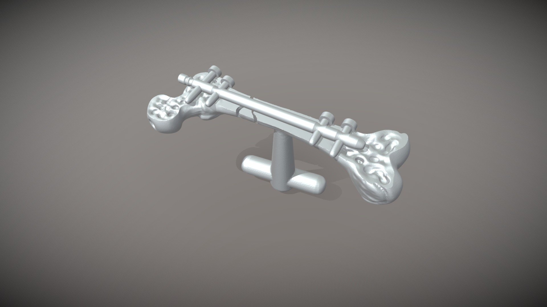 Femur cufflinks - fractured and fixed - 3D model by mdavisstudios ...