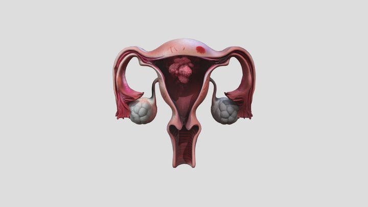 Uterus 3D models - Sketchfab