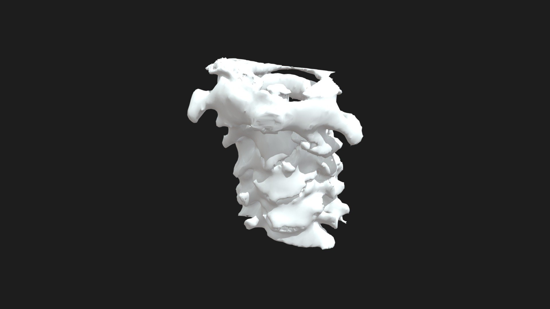 Upper Cervical III type C - 3D model by MT.MD [b6adf34] - Sketchfab