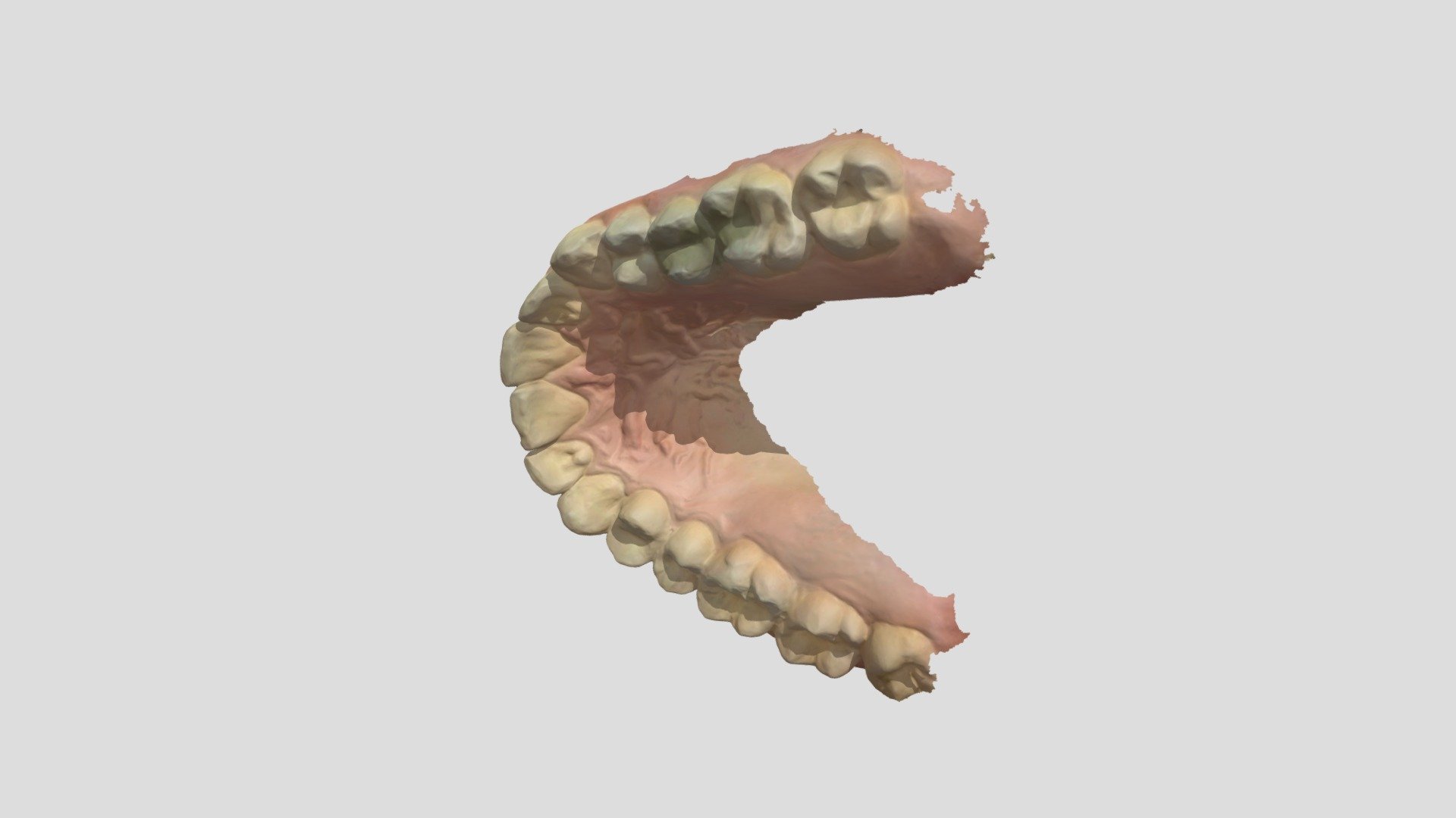 Upper Jaw Scan - 3D model by clinicrezaei [b6d1a17] - Sketchfab