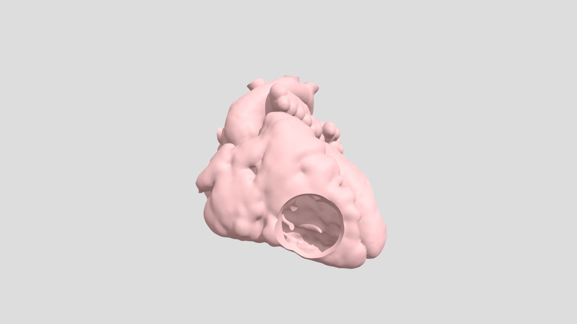 Vascular Ring, VSD (H0340) - 3D model by NCHS Cardiac Advanced Projects ...