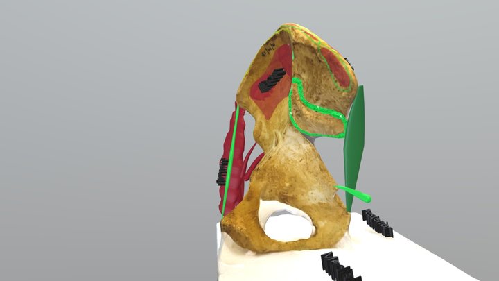 Anterior-superior-iliac-crest 3D models - Sketchfab