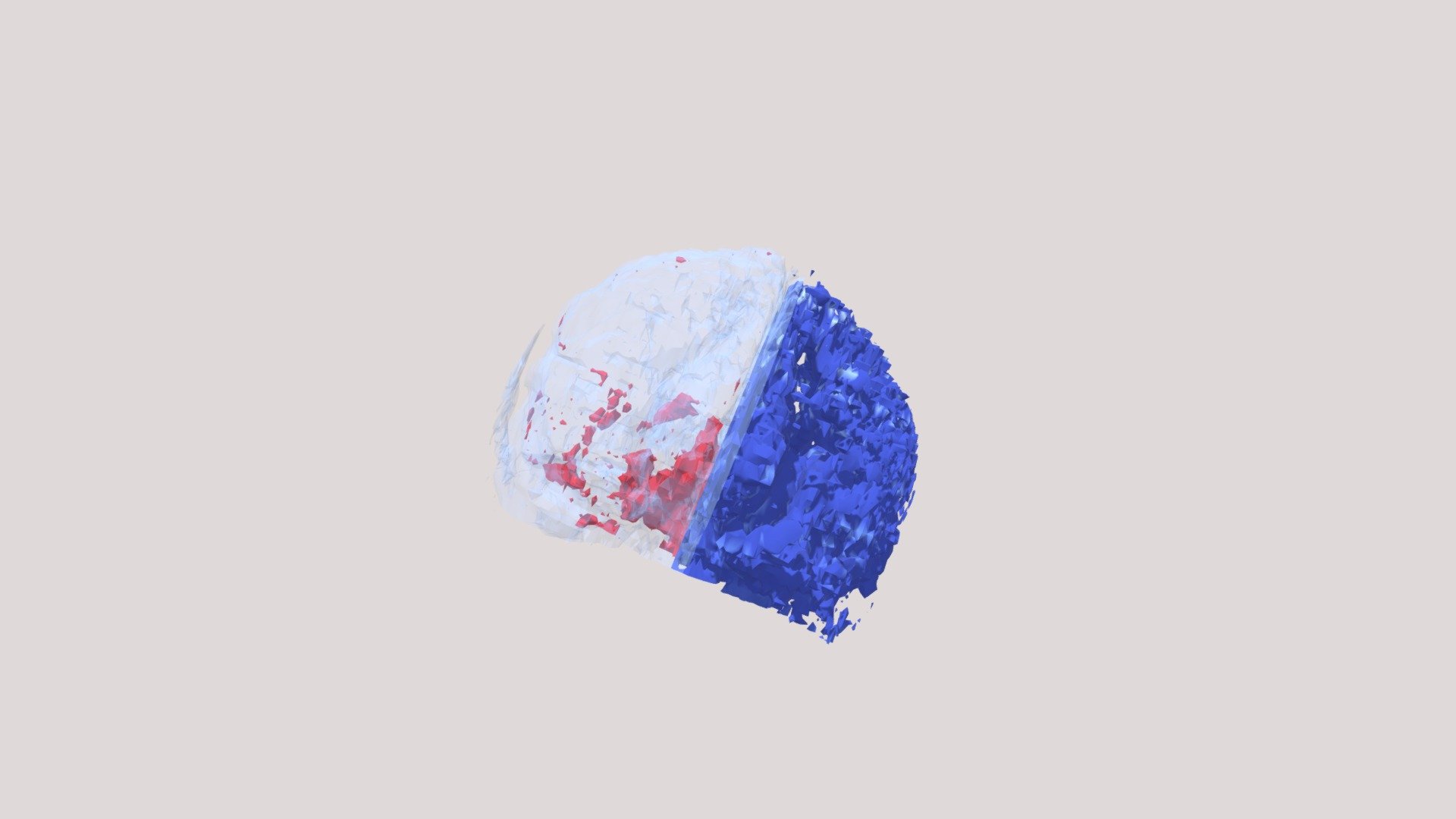 FMRI - 3D model by Vivek22 [b7ce335] - Sketchfab