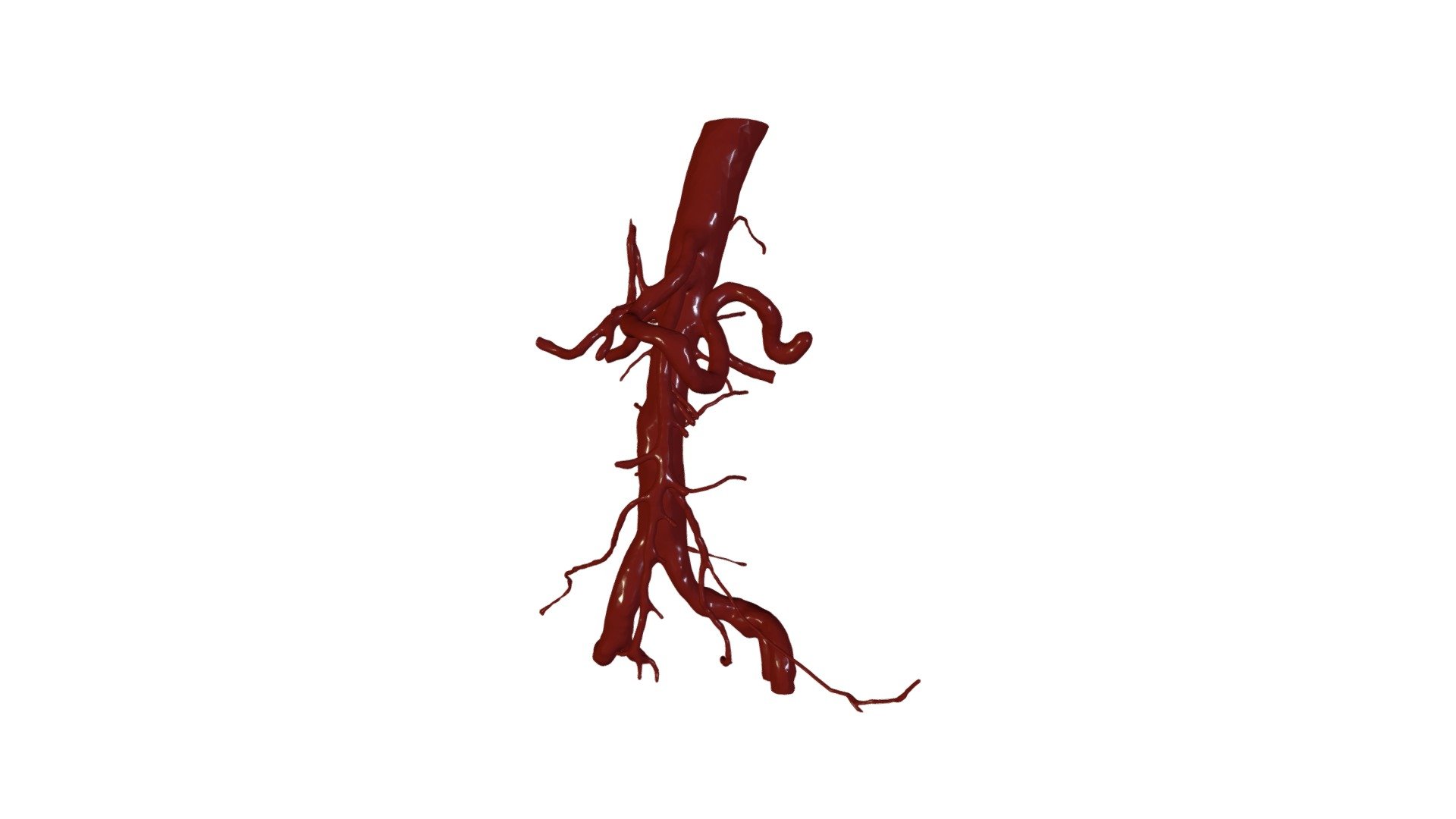Aorta abdominal - 3D model by LIMA.UNLP [b8add8c] - Sketchfab