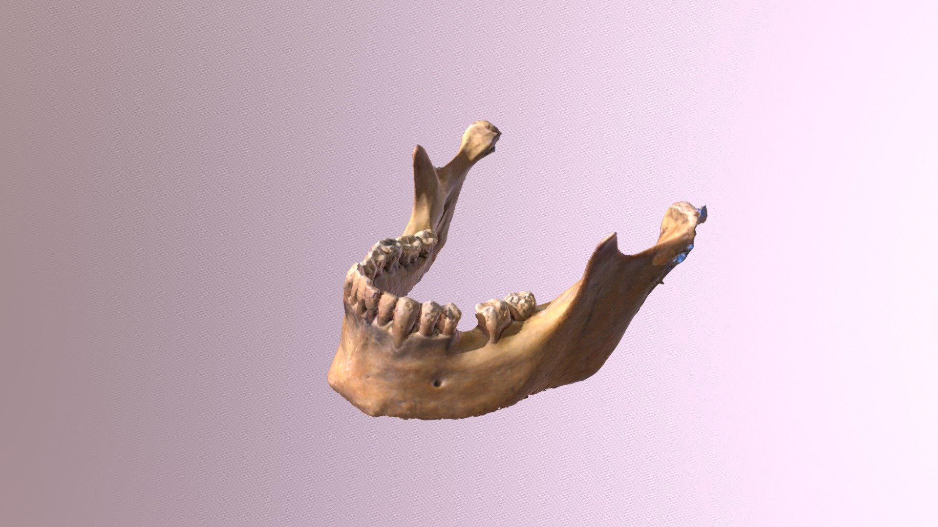 Mandíbula adulto - Adult mandible - 3D model by dr.miamoto [b8b0431 ...