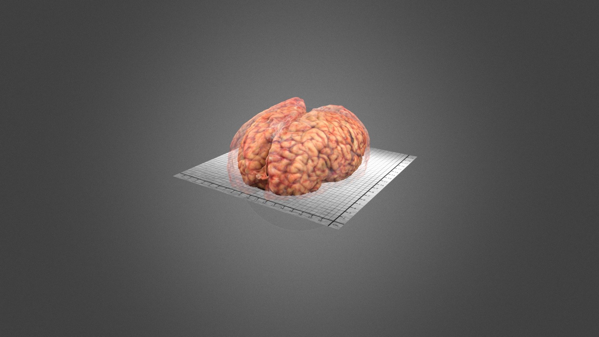 Size comparison healthy vs Alzheimer's brain - 3D model by ...
