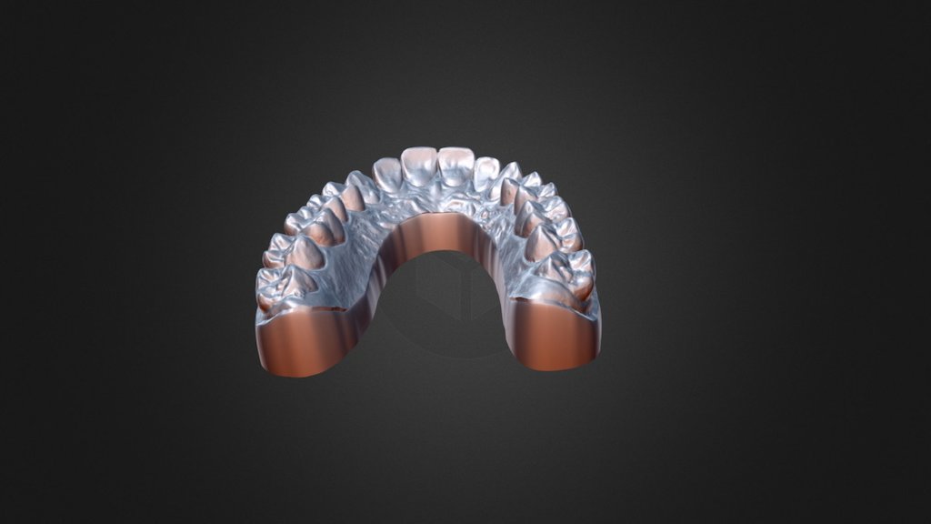Marko's Maxilla in 3D - 3D model by markotadrosdmd [b930282] - Sketchfab