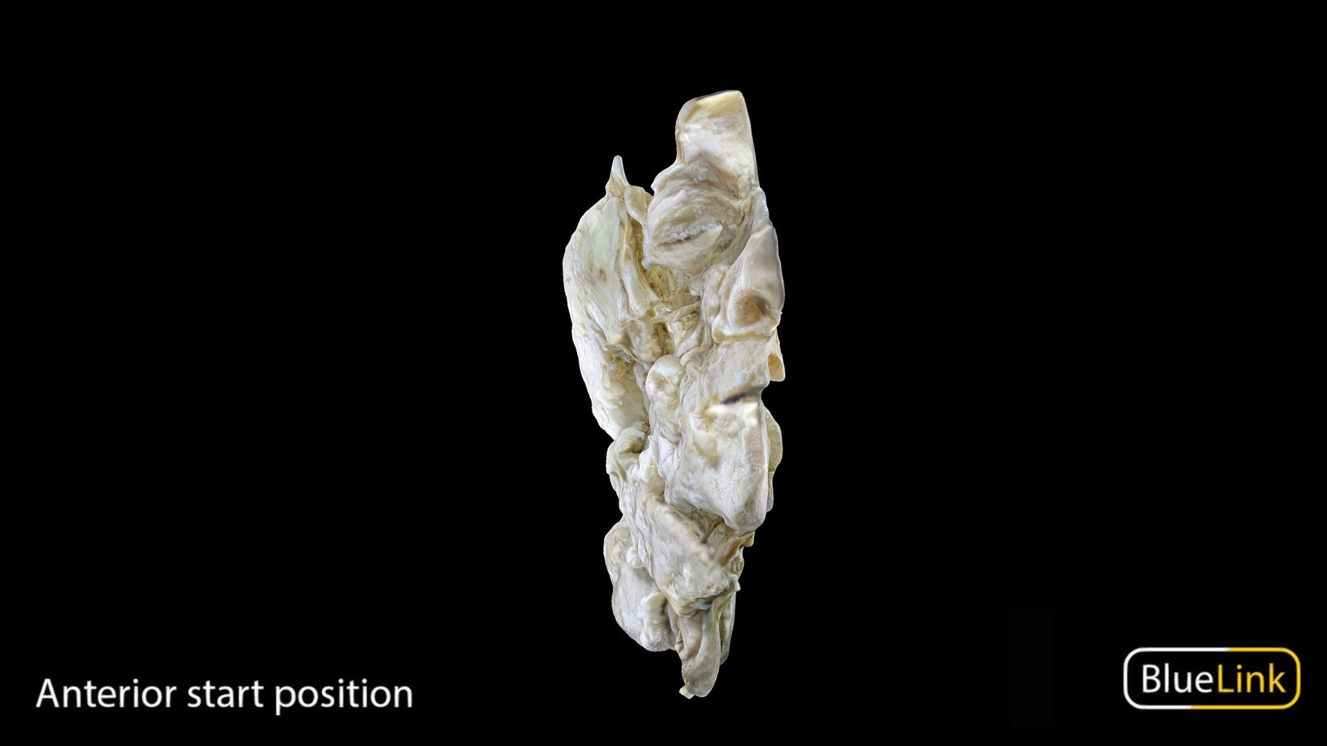 Head and Neck Hemisected Right - 3D model by Bluelink Anatomy ...