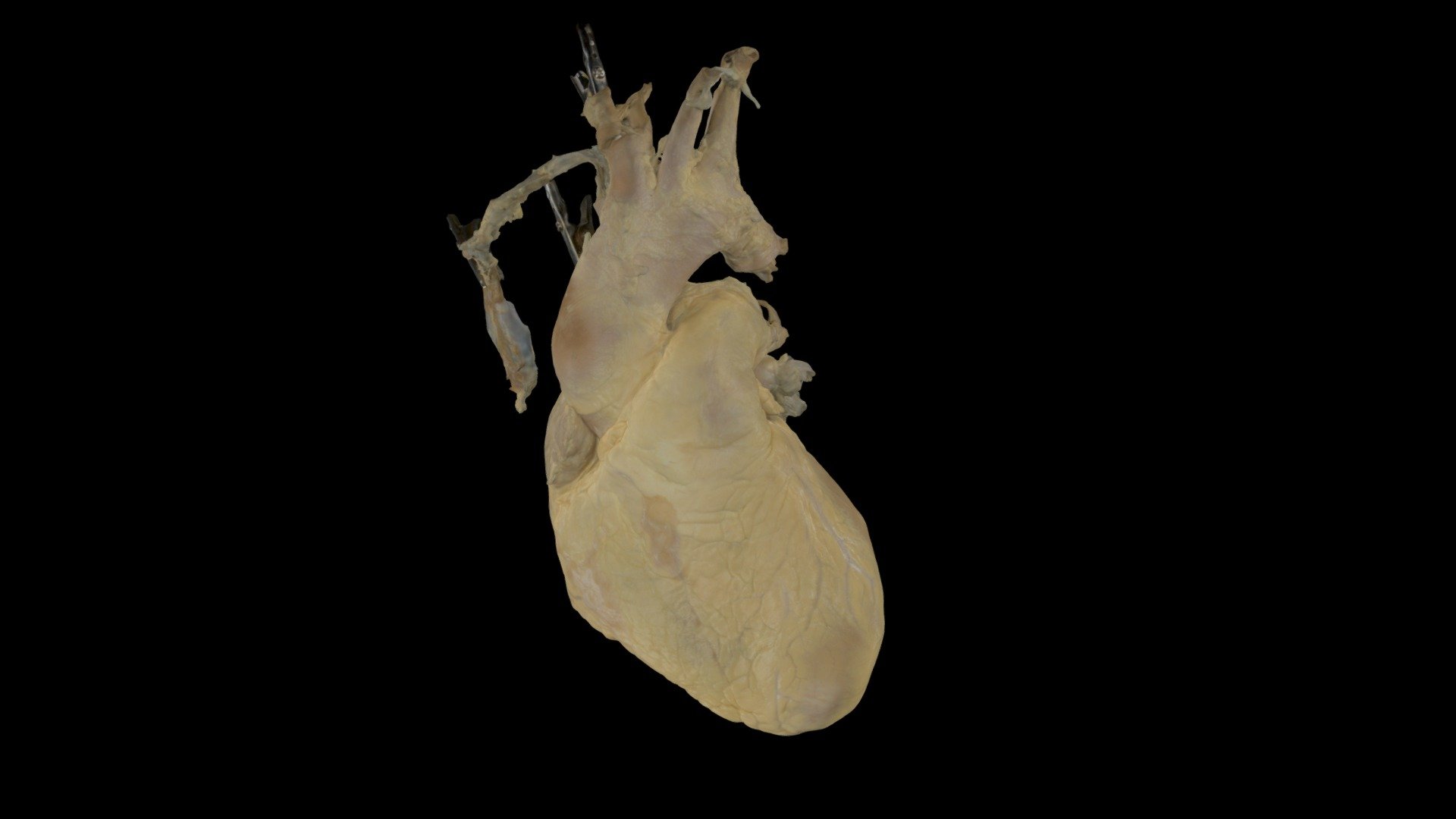 Fixed Human Heart with Pacemaker - Download Free 3D model by ...