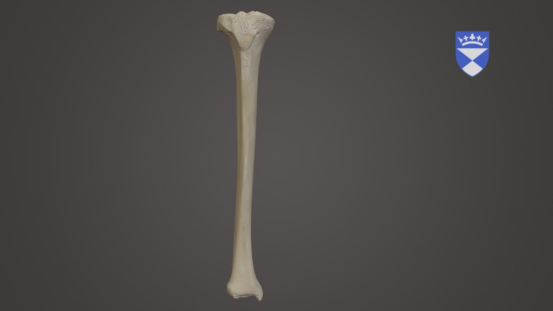 Tibia - 3D model by University of Dundee, CAHID (@anatomy_dundee ...