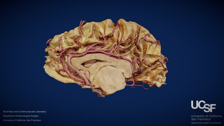White-matter 3D models - Sketchfab