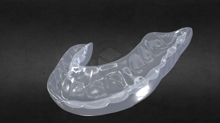 Invisalign 3D models - Sketchfab