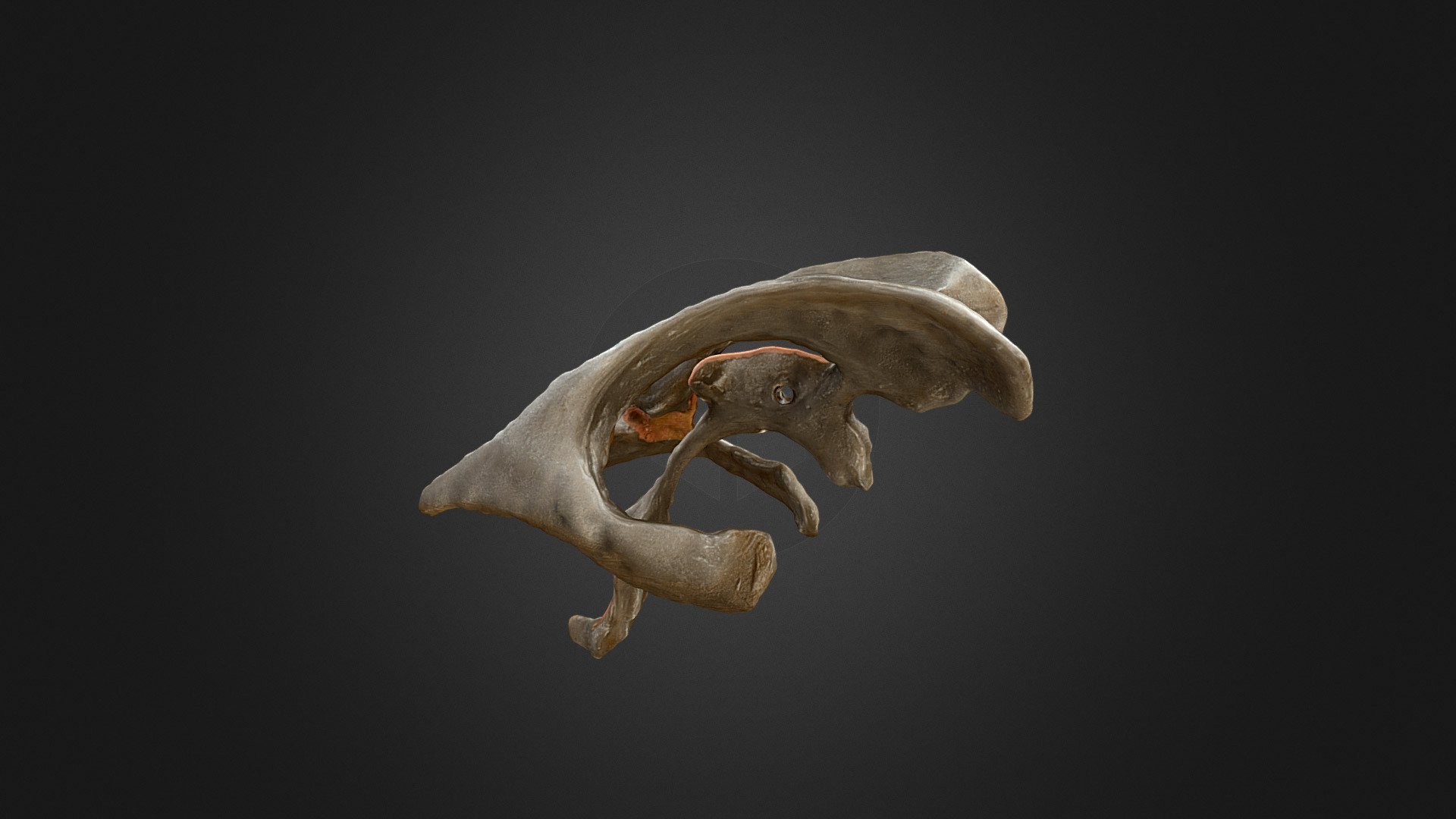Brain Ventricles - 3D model by Living Anatomy (@NYUSOMAnatomy) [b9f325d ...