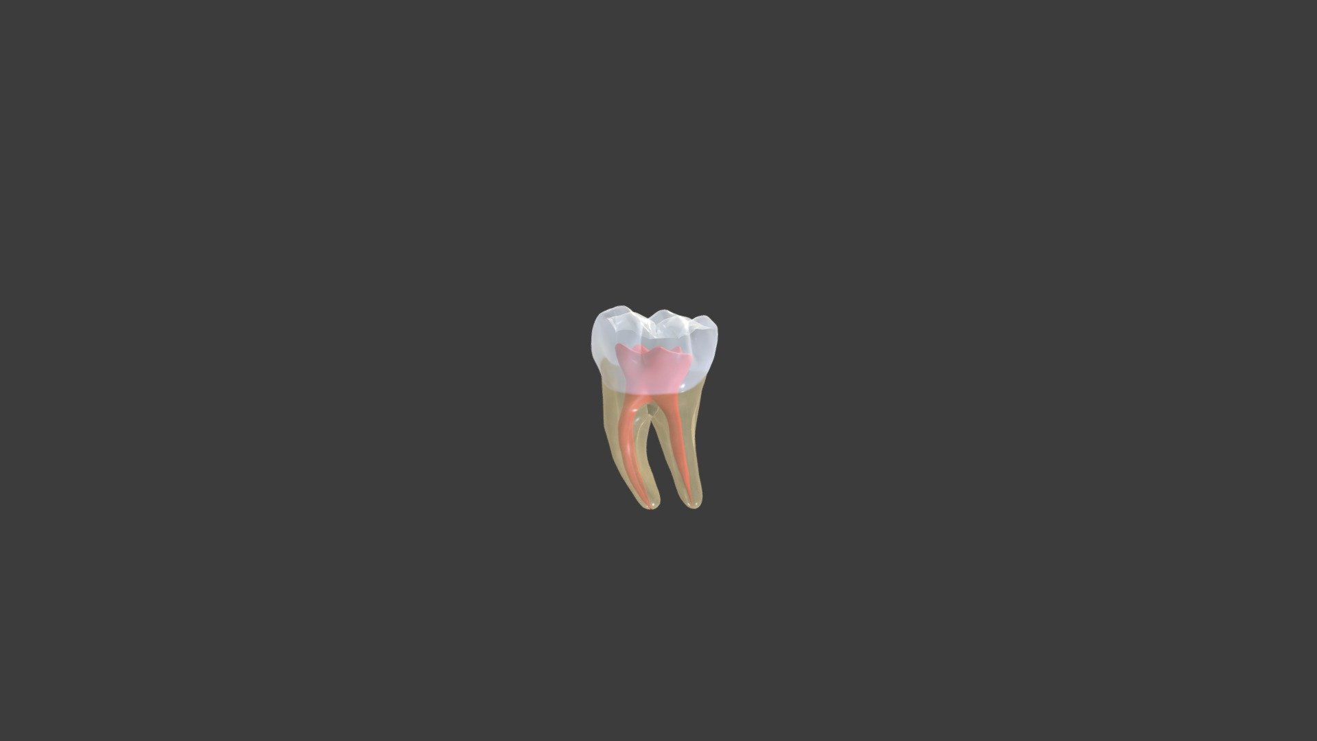 Mandibular 1st molar RCT_ - 3D model by Ahmed Mahrous (@drahedmahrous ...