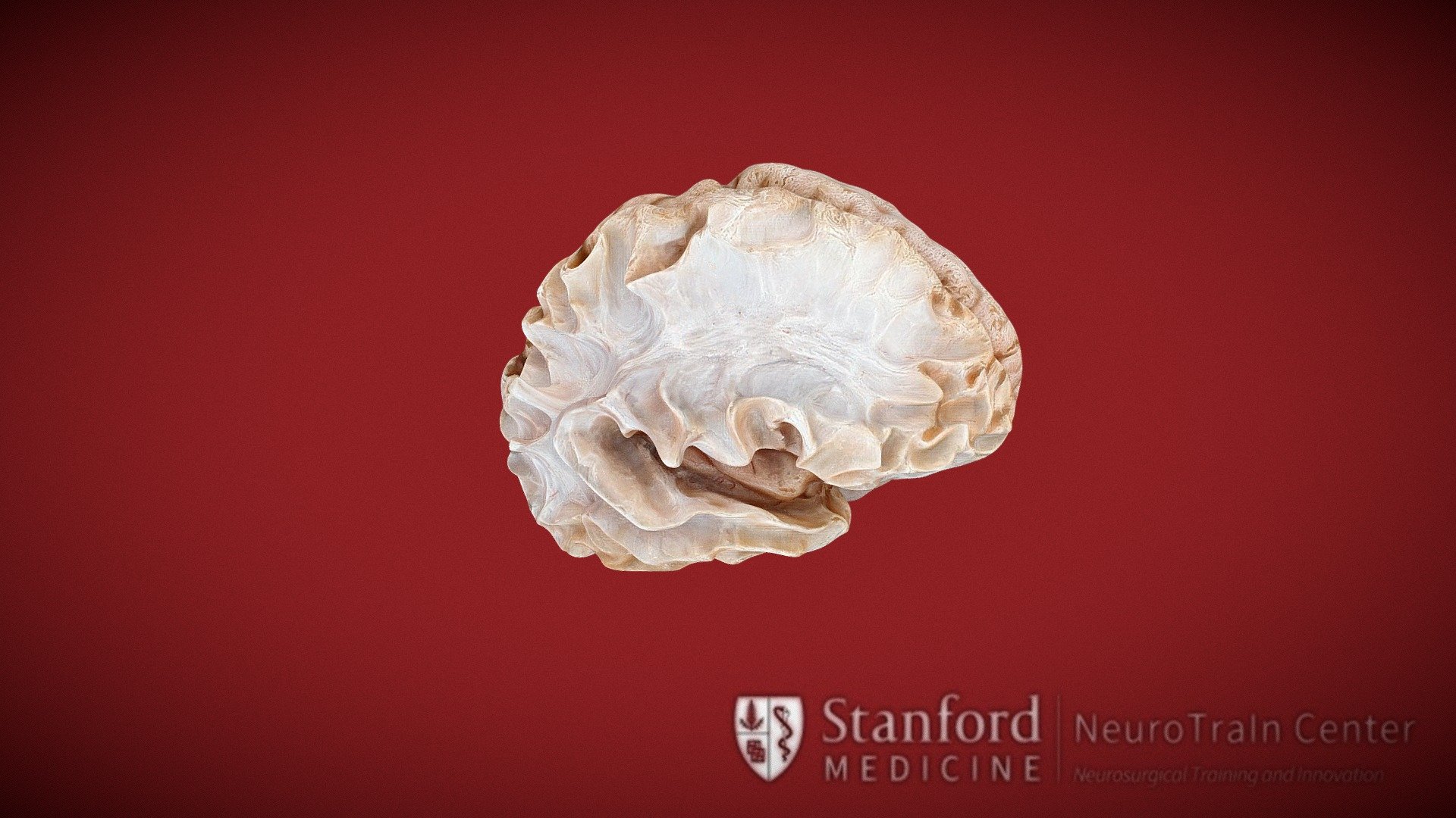 Arcuate Fasciculus 3d Model By Vv Verav [ba0ef37] Sketchfab