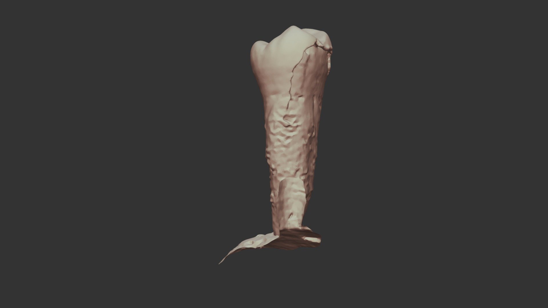 Tooth 20-group 10-scanner 6 Lower Jaw - 3D model by UMdental [ba48786 ...