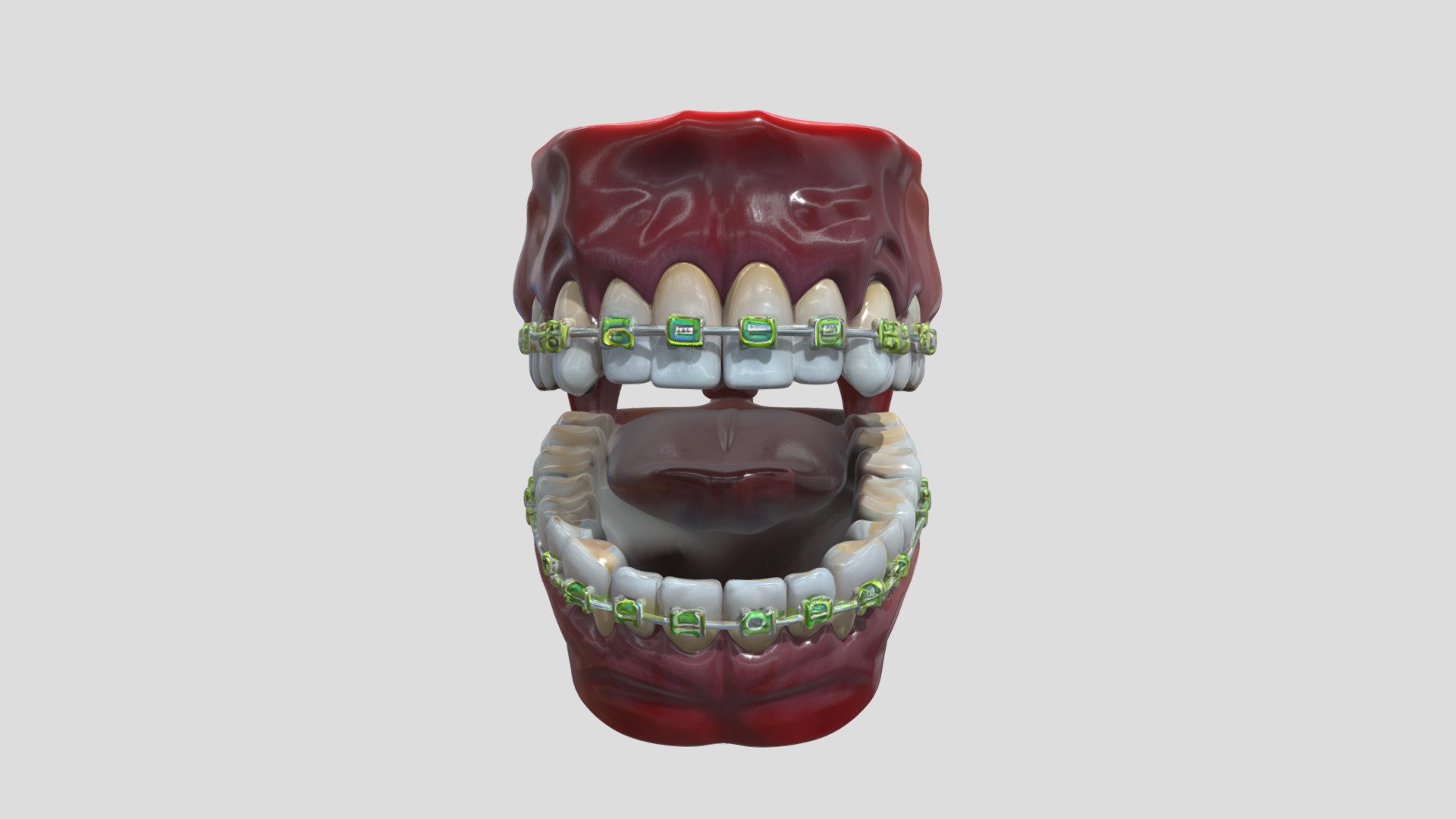 Human Mouth with Dental Braces - 3D Model - 3D model by Lolo909 ...