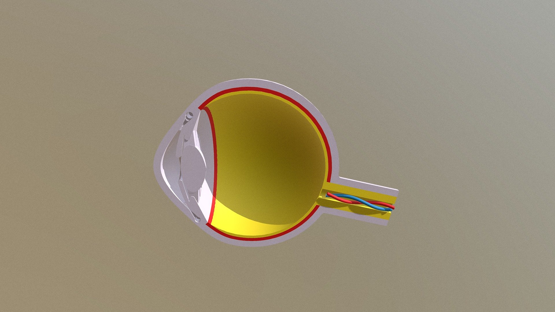 Glaucoma Open and Closed Angle - 3D model by Michaeltriggs [ba9bb57 ...