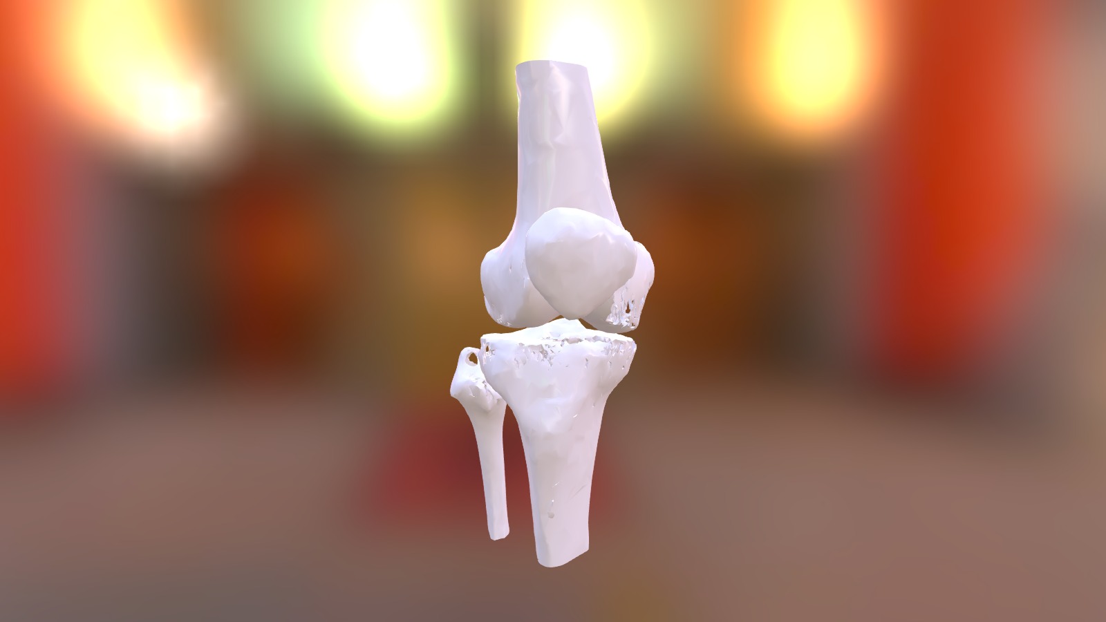 Knee - sku 061 - 3D model by orto3d [bb4a485] - Sketchfab