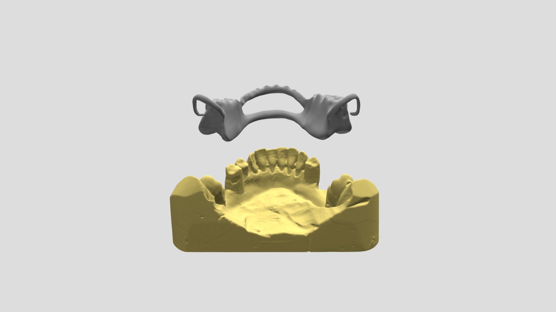 Lingual Bar with Cingulum Bar - Download Free 3D model by SDEO [bc0f69a ...