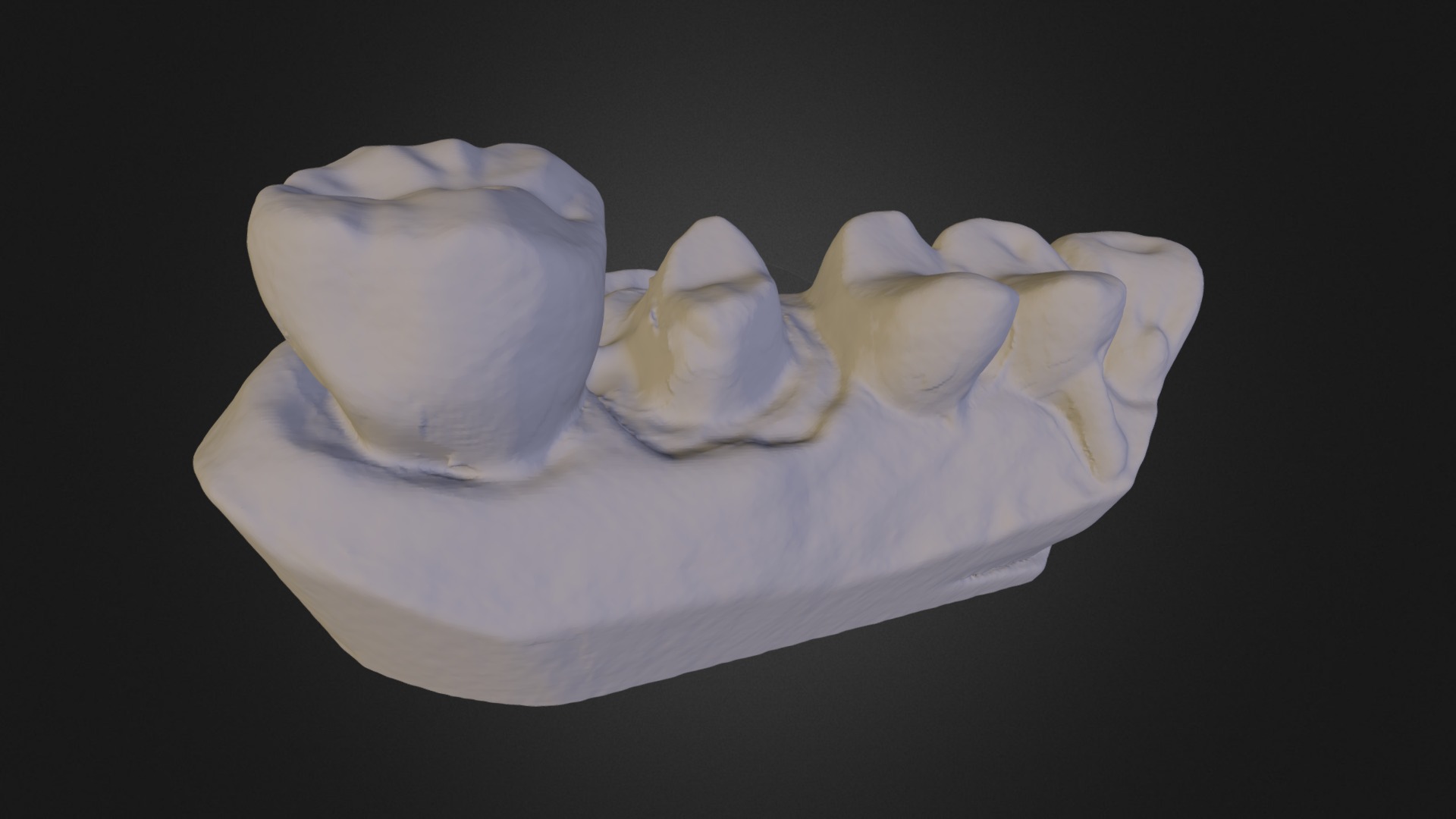 Dental 3D Scan - 3D model by OptimumARC (@optimumarc.com) [bcc831c ...