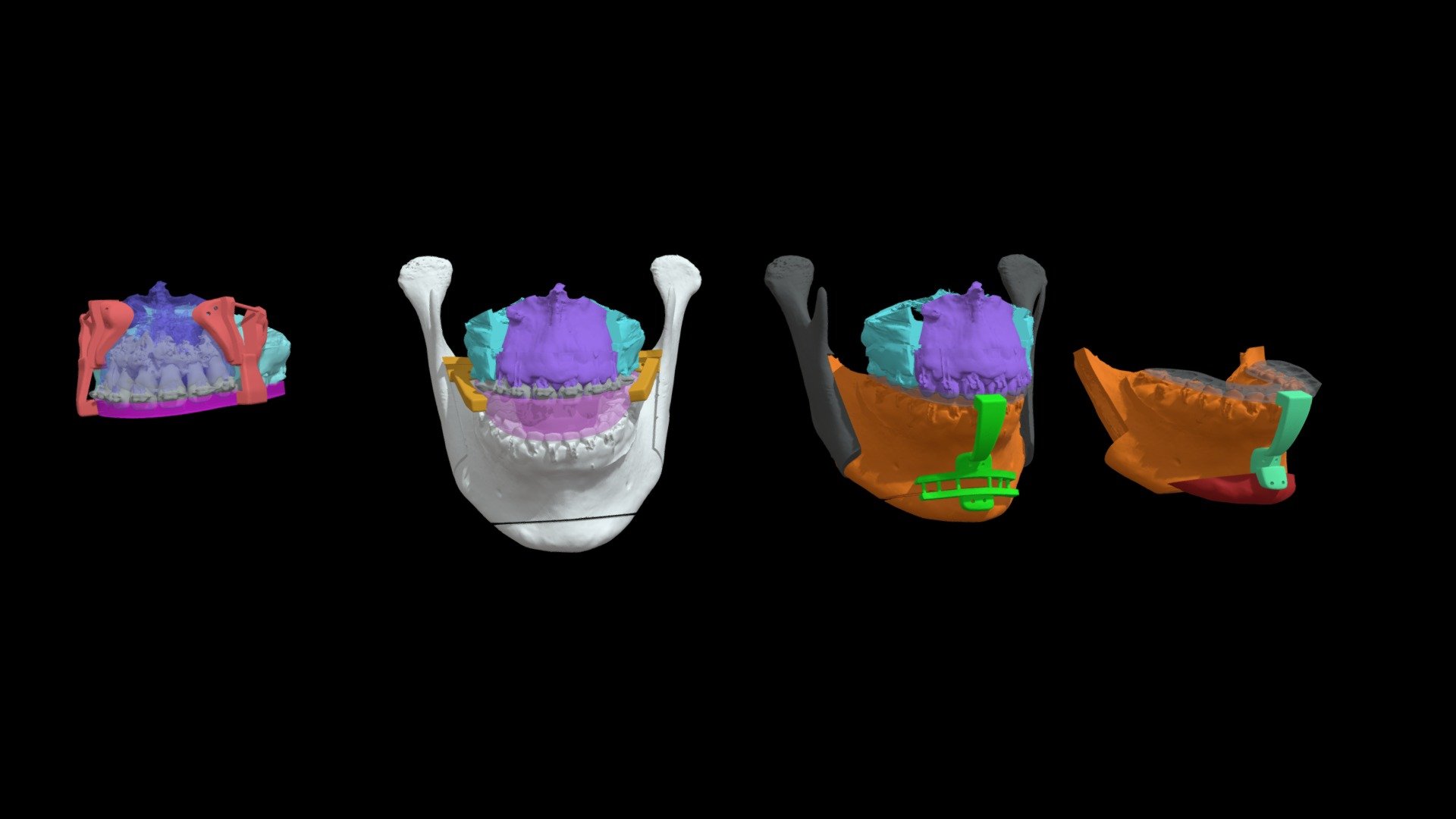 MMH DR.ZHENG -0907 - 3D model by vivian.detekt [bcda797] - Sketchfab