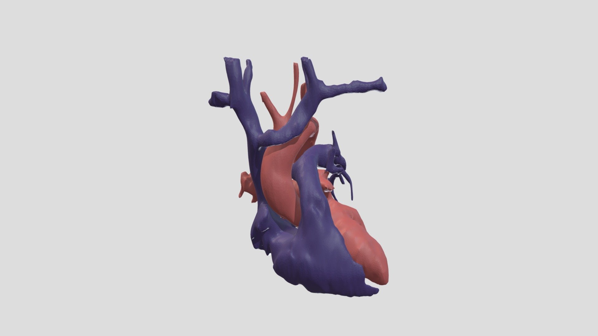 Normal Superior Vena Cava (SVC) Anatomy - Download Free 3D model by ...