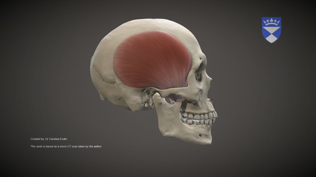 Temporalis muscles - 3D model by University of Dundee, CAHID (@anatomy ...
