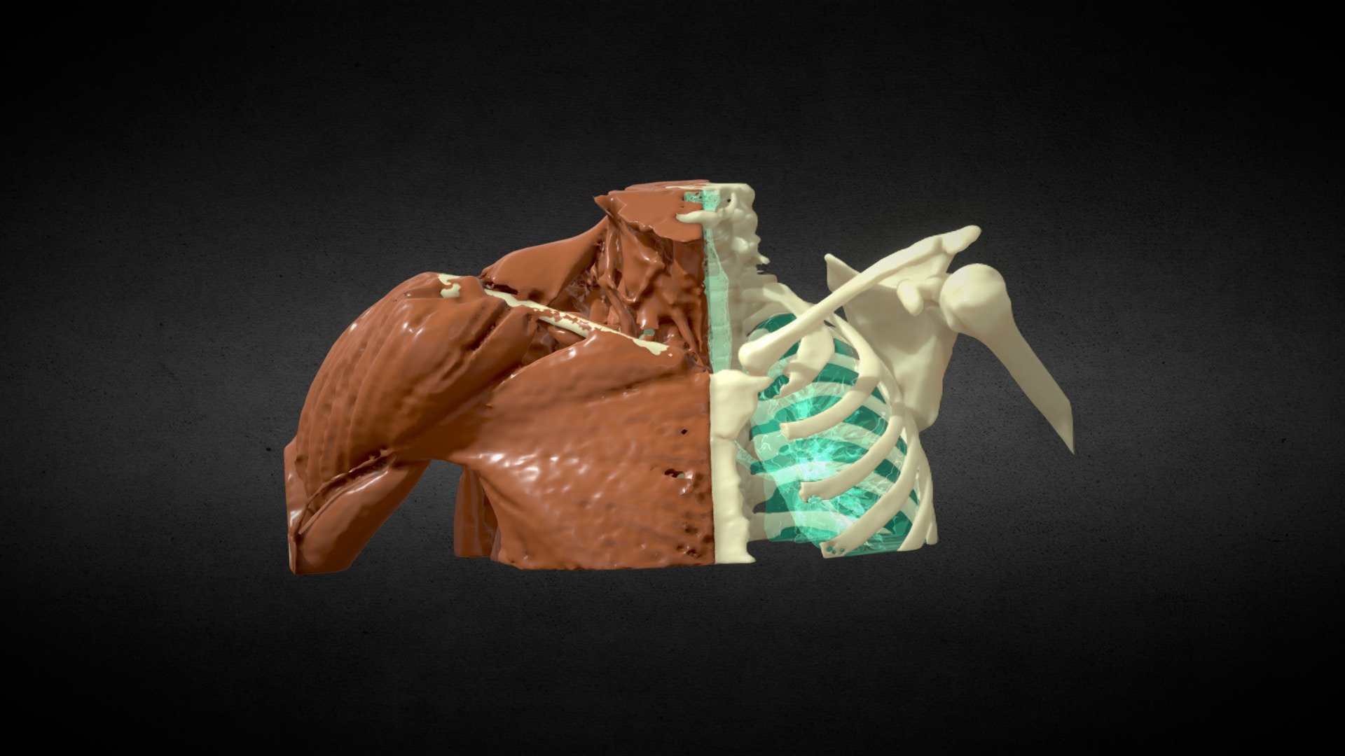 DICOM student final project Tekla S - 3D model by The Center for ...