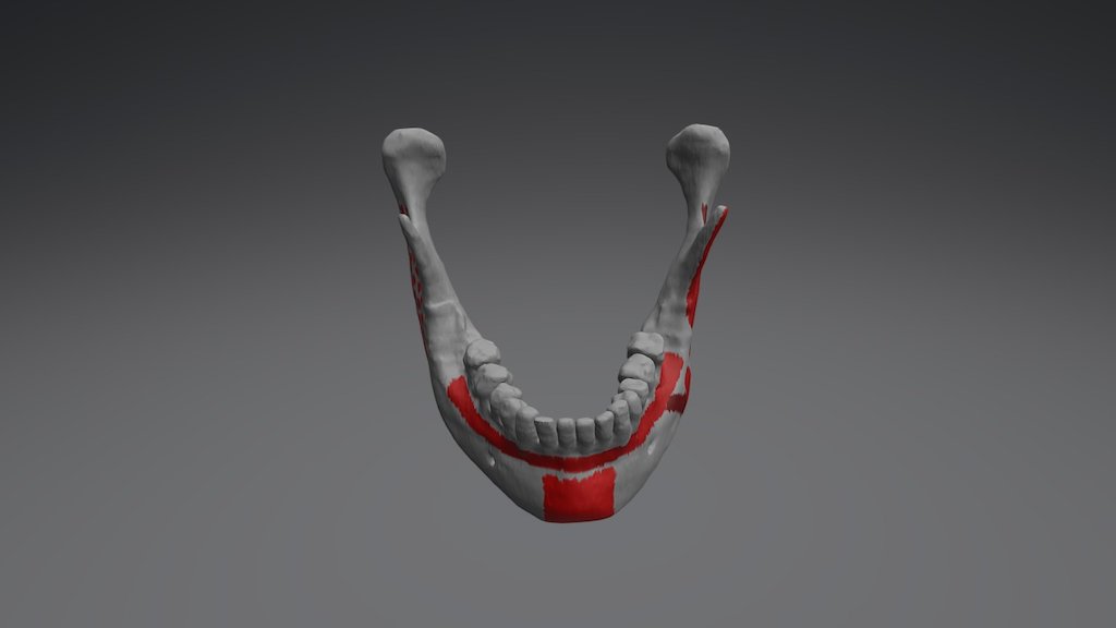 Mandíbula - 3D model by Clínica 3D (@clinica3d) [bdbce51] - Sketchfab