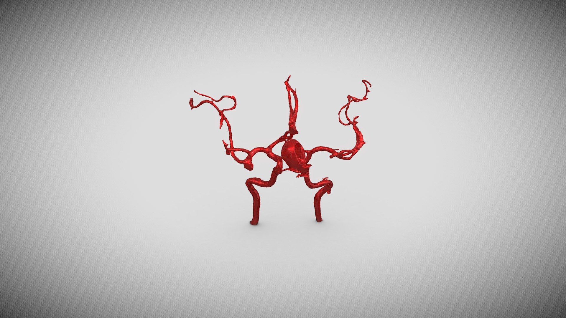 Big ICA Ophtalmic Aneurysm - Buy Royalty Free 3D model by Dr. Samuel ...