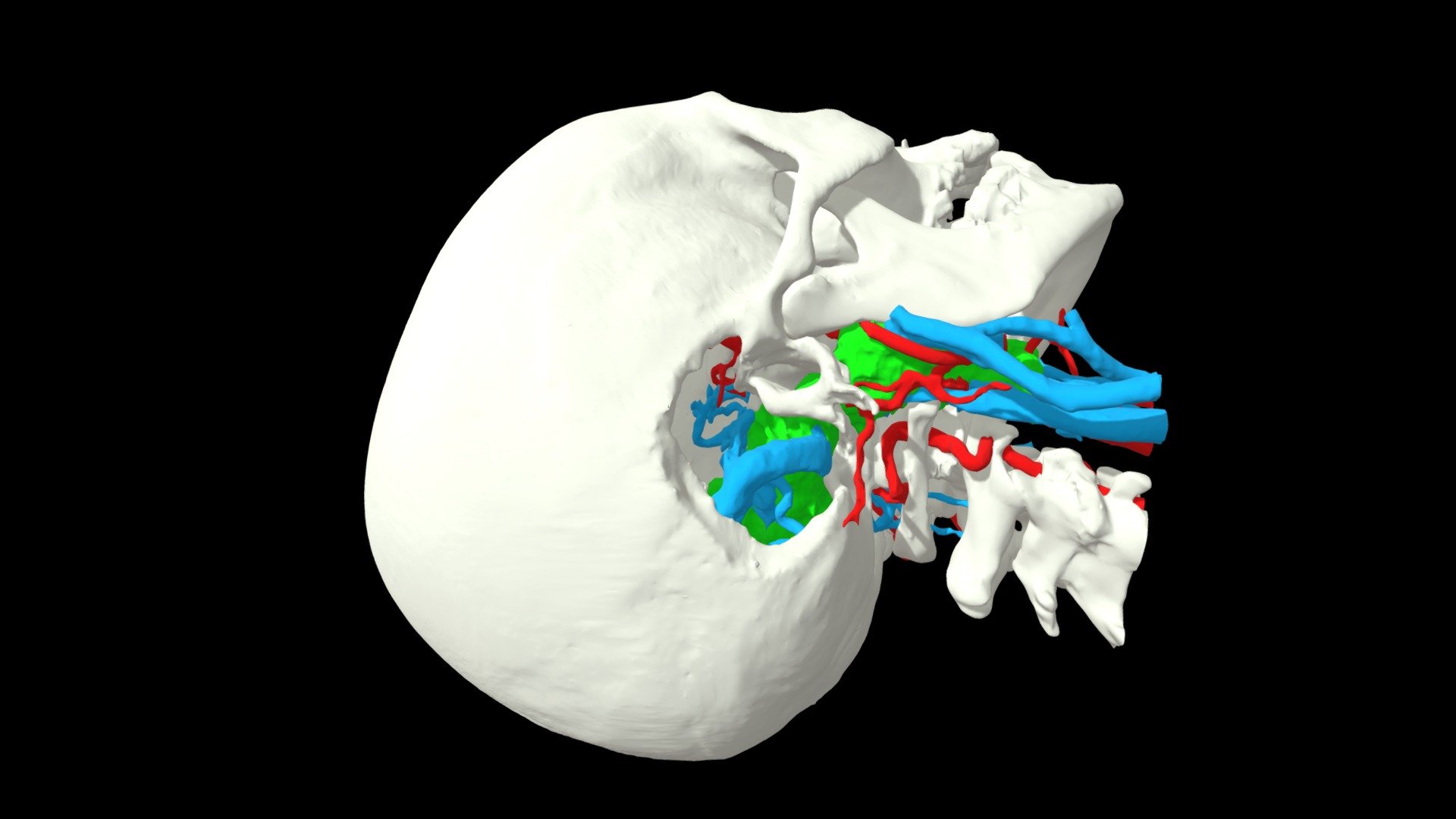 SB0028 TRANS-OTIC - 3D model by SkullBasics [bdf829a] - Sketchfab