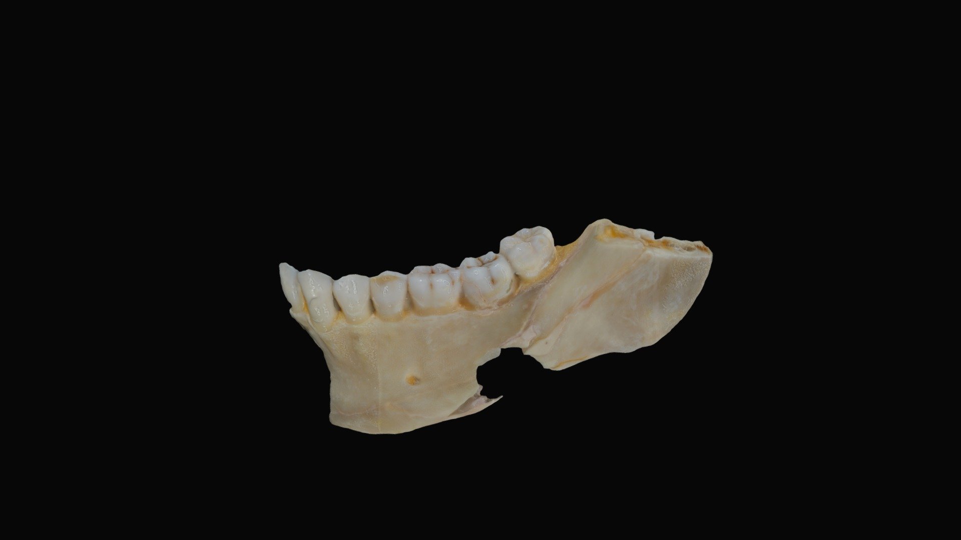 Mandible - 3D model by IslandMedicalProgramAnatomy [bdfd0ed] - Sketchfab