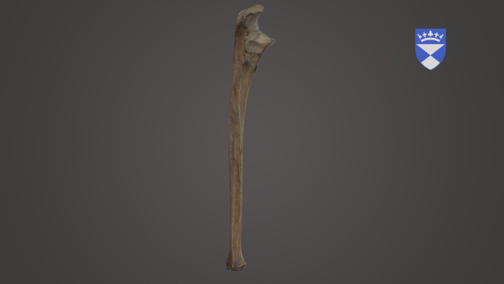 Ulna - 3D model by University of Dundee, CAHID (@anatomy_dundee ...