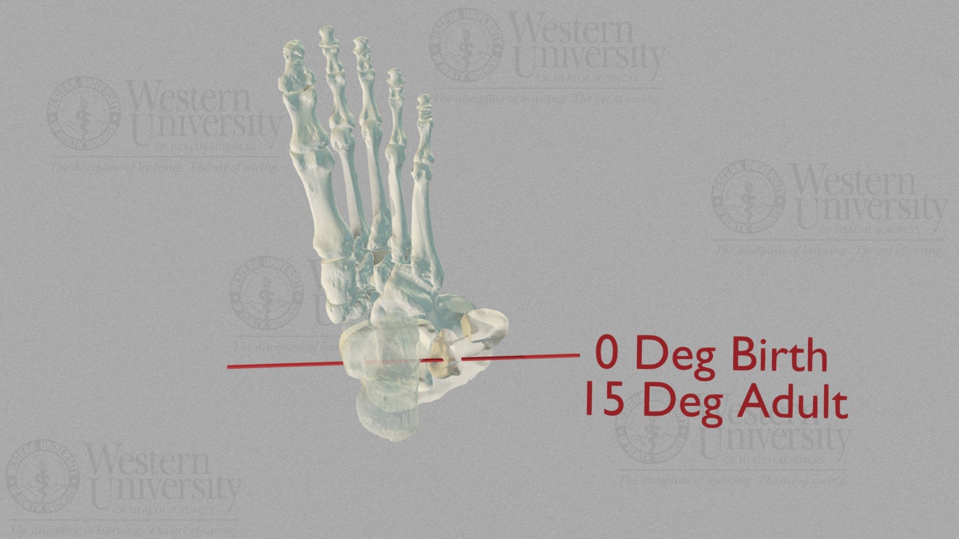 Malleolar Position of Tibia at Birth - 3D model by WesternU3D [be805d6 ...