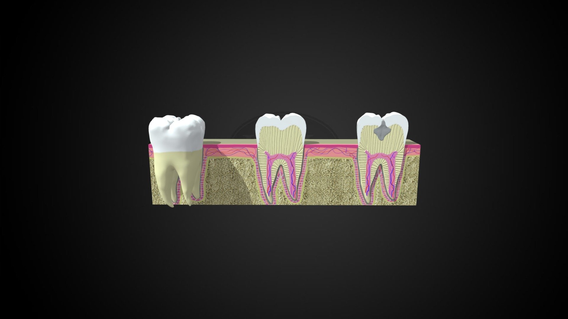 Molar tooth with cross section and cavity - 3D model by iqcenter ...