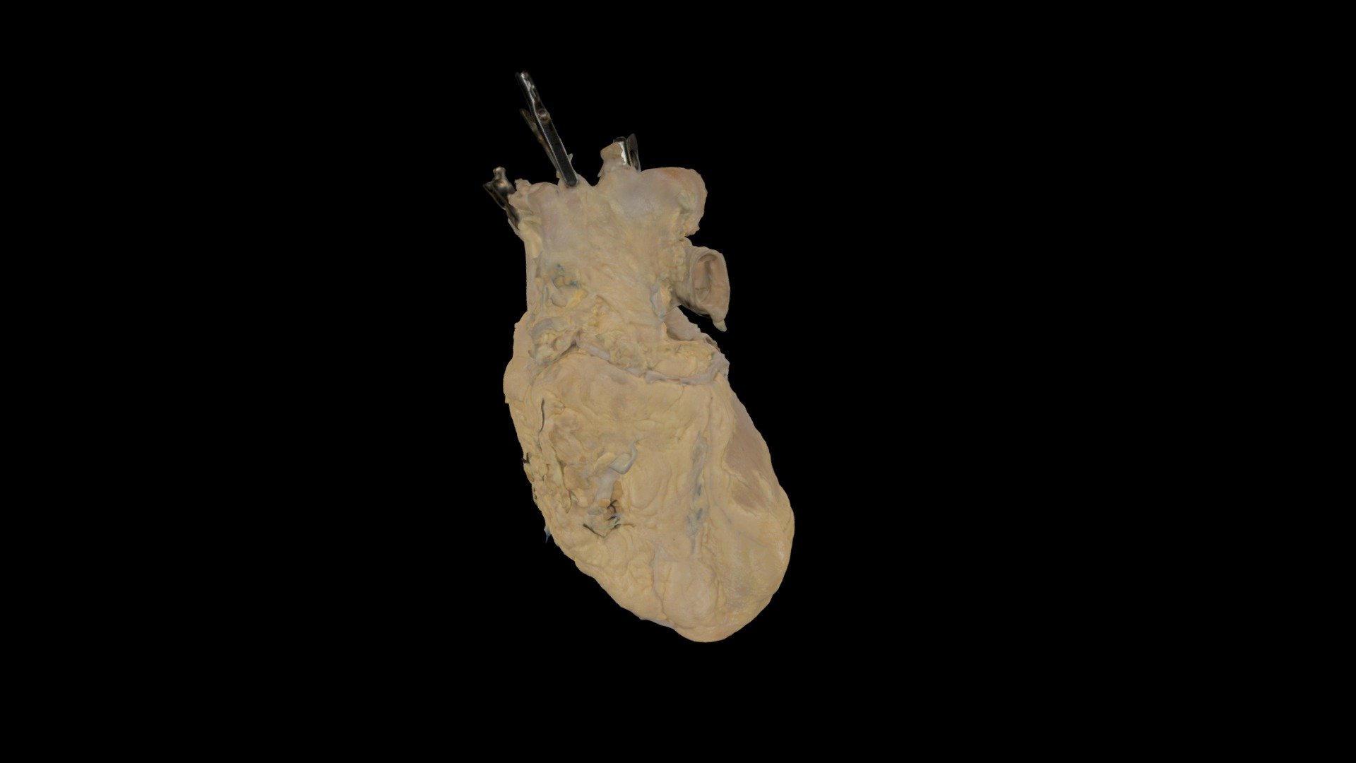 Perfusion Fixed Human Heart Donation #207 - Download Free 3D model by ...