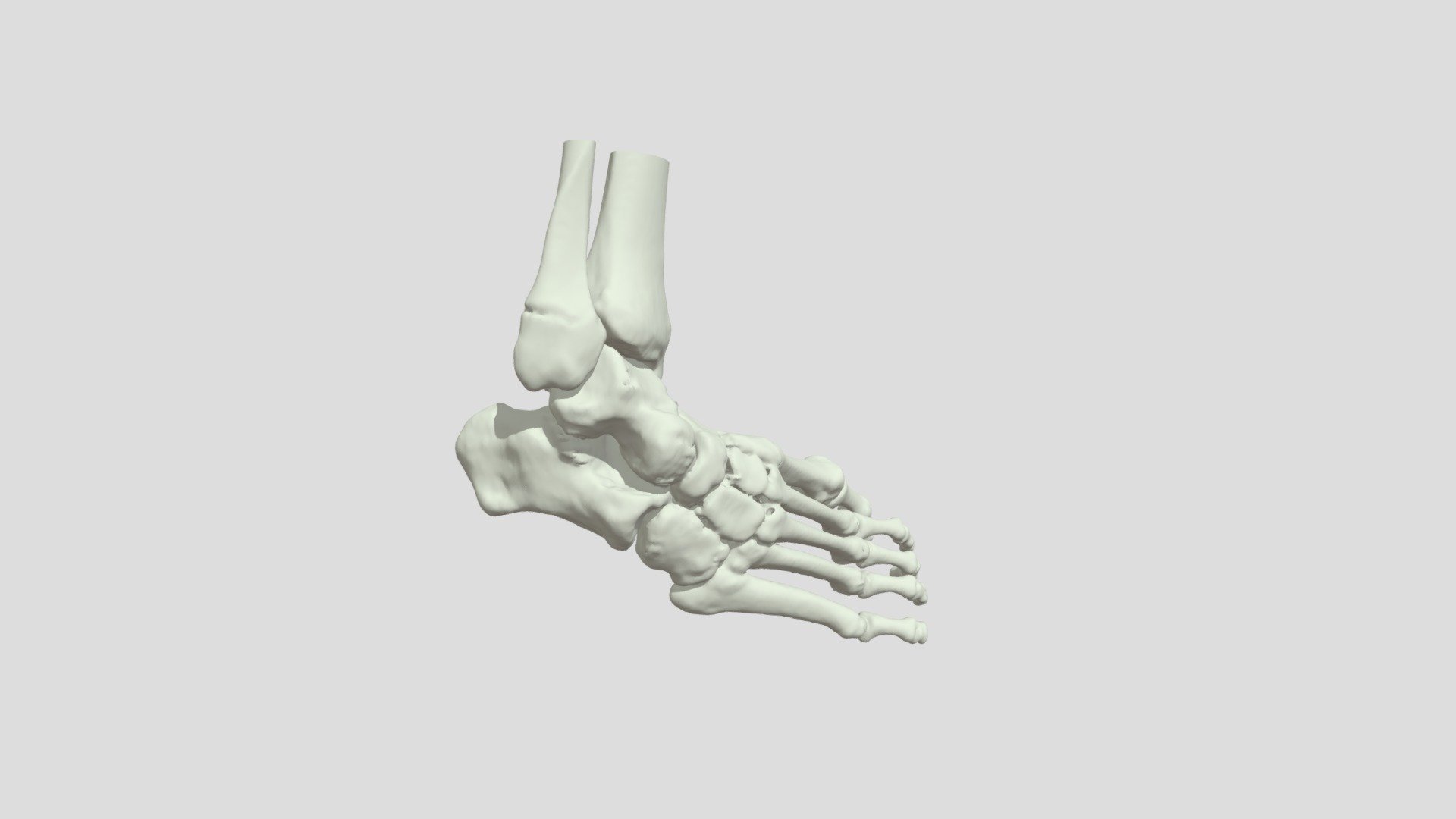 Cavovarus Foot Deformity (S0301) - 3D model by NCHS Cardiac Advanced ...