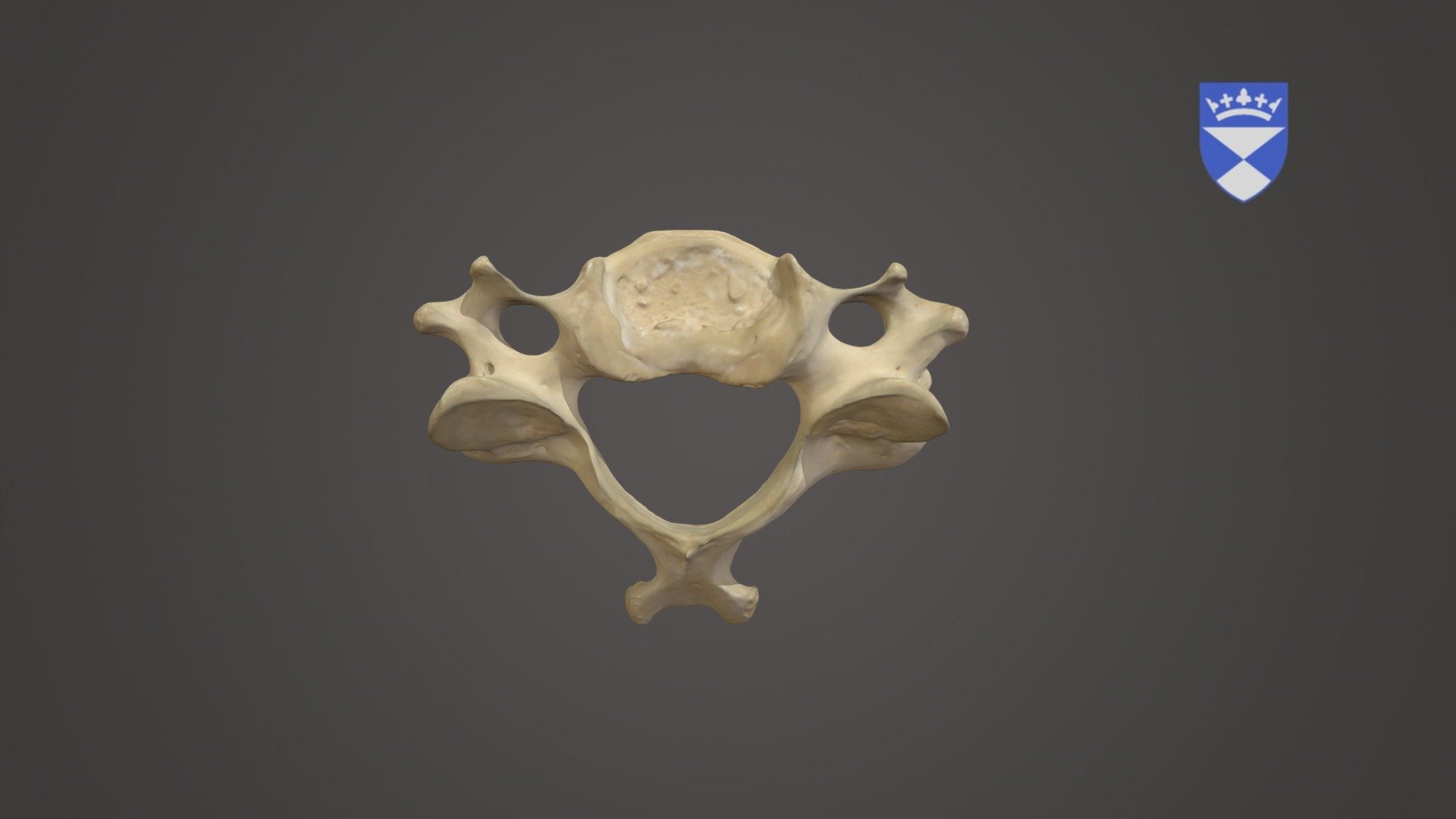 Cervical Vertebra - 3D model by University of Dundee, CAHID (@anatomy ...