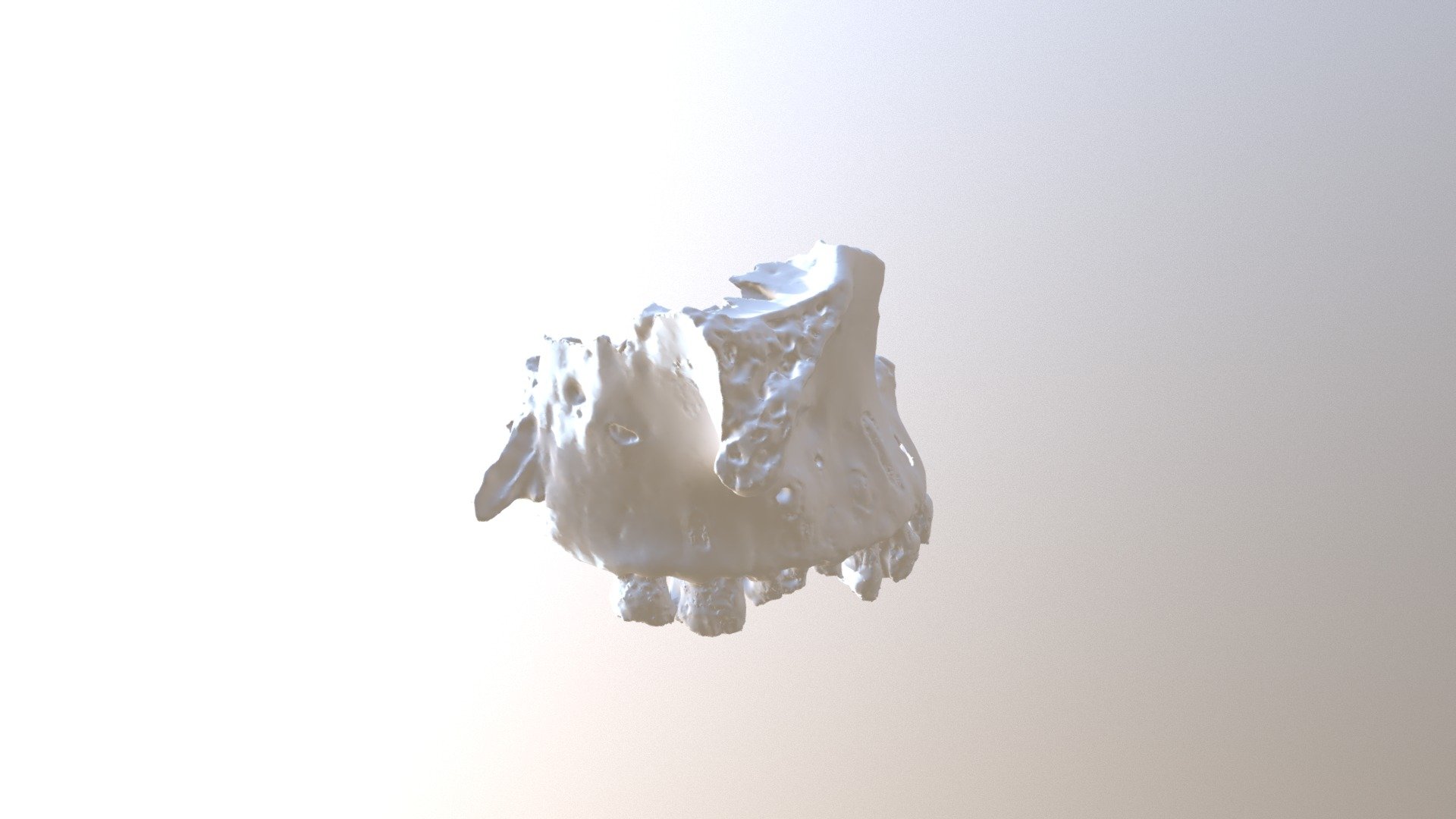 Leprosy - Maxillae (01) - 3D model by BU Forensic Anthropology - Neil ...