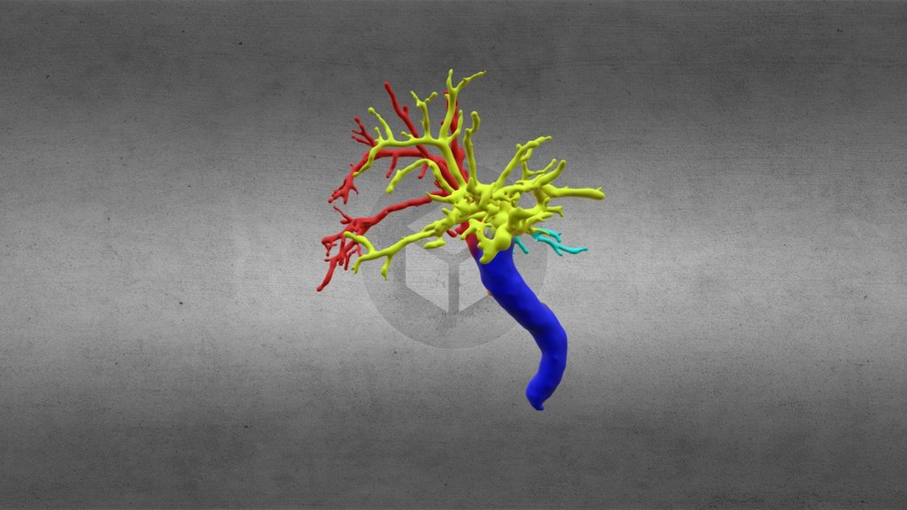 MRCP - 3D model by jonbra [c009776] - Sketchfab