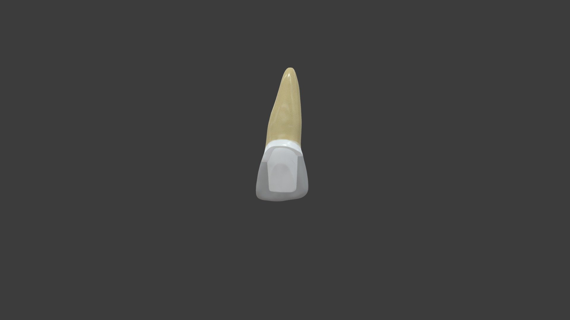 Anterior all Ceramic Crown Prep - 3D model by Ahmed Mahrous ...