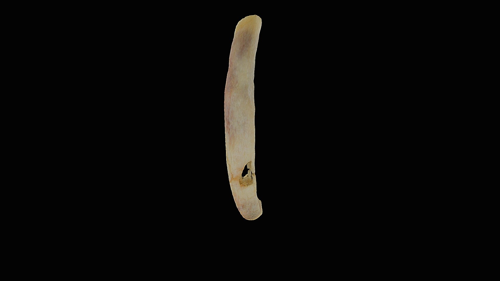 3rd Rib GSW - 3D model by IslandMedicalProgramAnatomy [c04e0cb] - Sketchfab