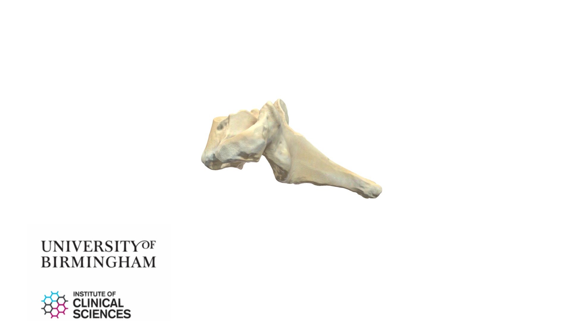 Vertebra Prominens - 3D model by UoB_Anatomy [c06648e] - Sketchfab